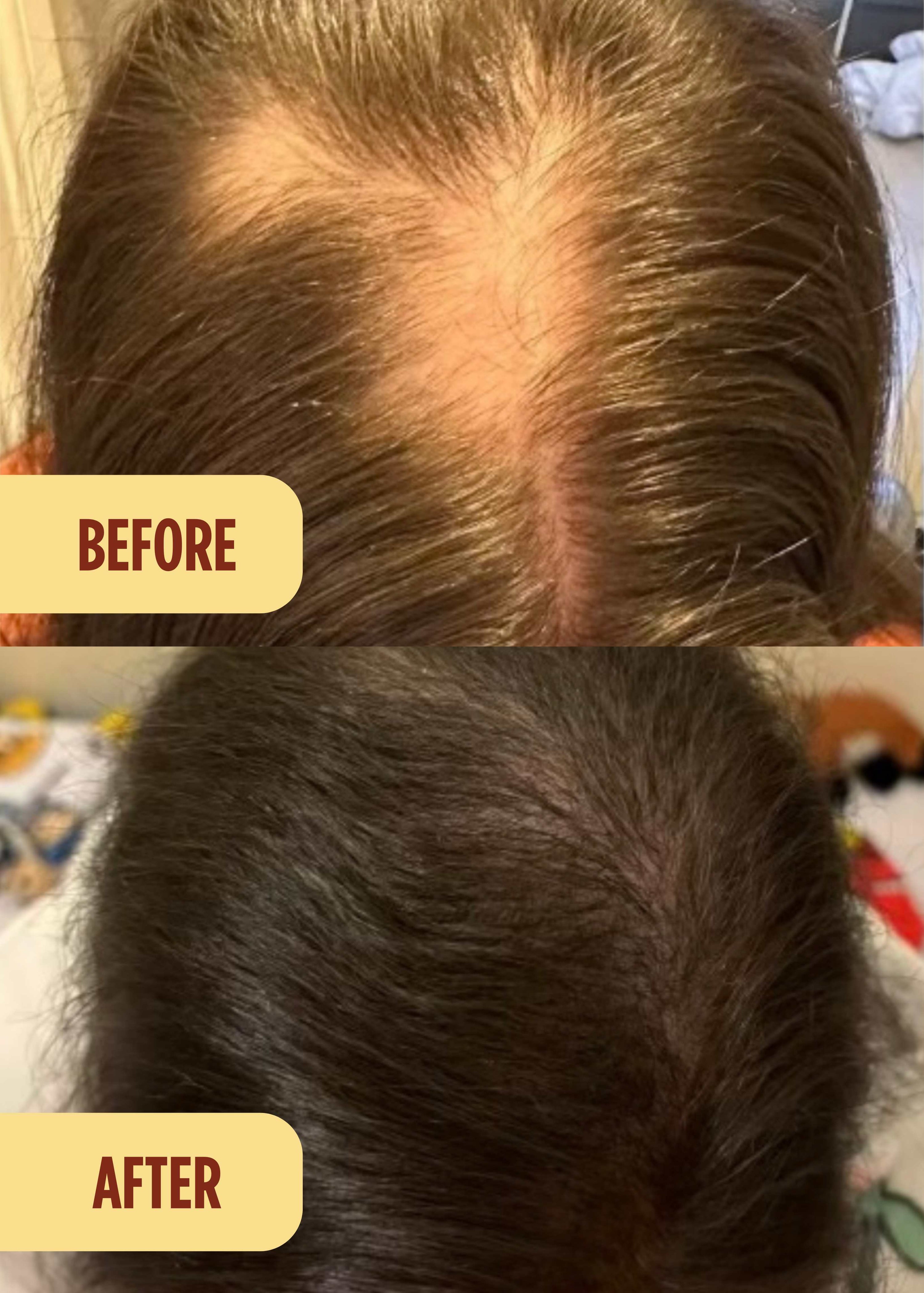 Rosemary Hair Oil | GrowsMary | Hair Syrup